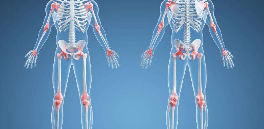 Corrective Exercise - Inspire Fitness for Wellbeing | Exercise Physiology